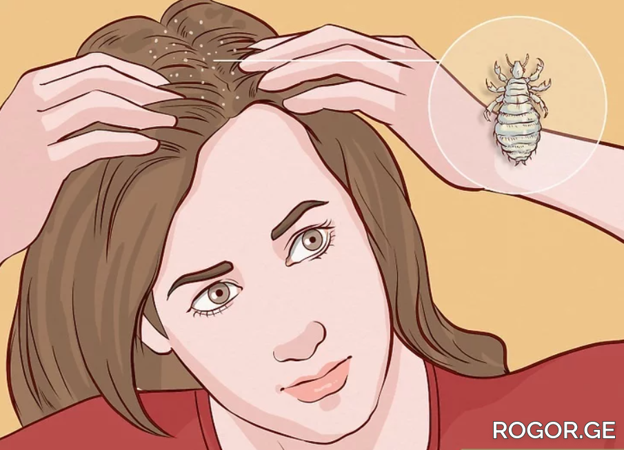 როგორ მოვიშოროთ ტილები - rogor.ge